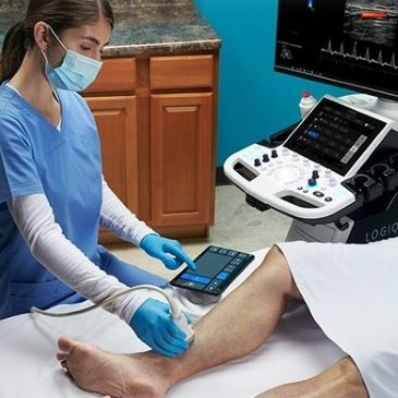 LOGIQ™ P9 XDclear™| GE HealthCare