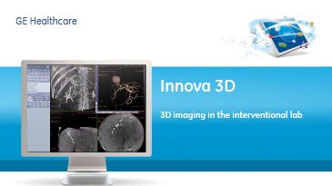 Innova 3D| GE Healthcare