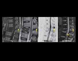 MERGE| GE HealthCare