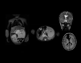 PROPELLER| GE HealthCare