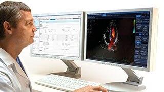 ViewPoint 6 y EchoPAC Suite para cardiología| GE HealthCare