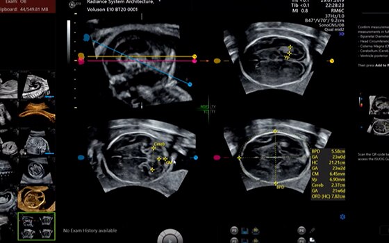 Voluson™ E10 | Women’s Health Ultrasound| GE Healthcare