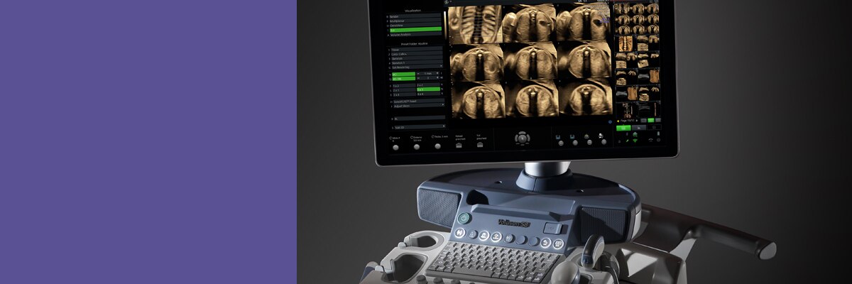 Voluson™ S8 | Women’s Health Ultrasound | GE Healthcare| GE Healthcare