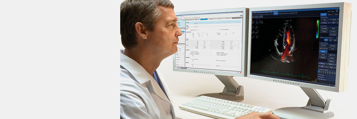 ViewPoint 6 y EchoPAC Suite para cardiología| GE Healthcare