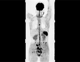 Aplicativo RM eDWI Body | GE HealthCare